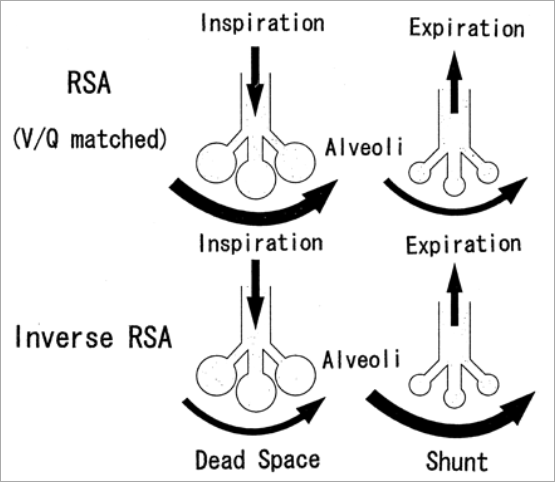 Medicine Decoded: Respiratory Sinus Arrhythmia- Why Does the Heartbeat ...